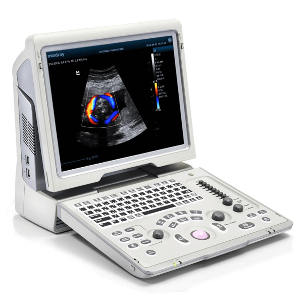 Ultrasonido Portátil con Batería Recargable Z5 a Color Mindray - Equipo ...